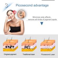 China 532nm 755nm Pico Laser Tattoo Removal Machine 1064nm Q Switch for sale