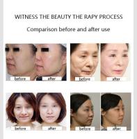 China Portable Painless HIFU Anti Wrinkle Machine Face Lift Vmax HIFU Treatment for sale