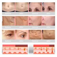 China Desktop 7D HIFU Beauty Machine Painless Ultrasound Body Slimming Device for sale