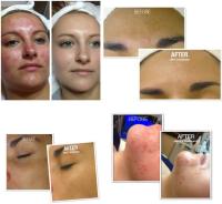 China Hydrodermabrasion Hydrafacial Beauty Machine 8 In 1 Skin Care Multifunctional for sale
