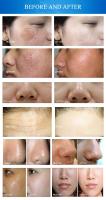 China 10 In 1 Skin Rejuvenation Hydrafacial Beauty Machine Multifunctional SPA639 for sale