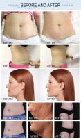 China Vacuum Suction Cryolipolysis Slimming Machine Spa Double Chin Removal Machine for sale