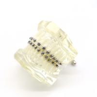 China 1st 2nd Bondable Single Molar Orthodontic Buccal Tube Metal Non Convertible for sale