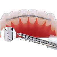 China ISO9001 2008 Certified Ortho Caps for Hot Dental Products Supply/Orthodontic OnTeeth Head Cap for sale