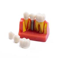 China Class III Instrument Classification Dental Study Model for Dental Practice and Demonstration for sale