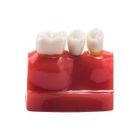 China Class III Instrument Classification Dental Study Model for Dental Practice and Demonstration for sale