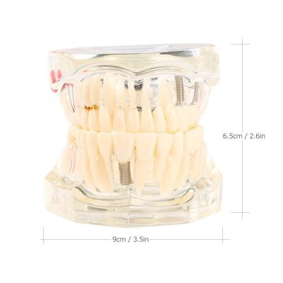 China Dental Student Education Model Standard for Dentistry Study Manual Power Source 2 Years Shelf Life for sale