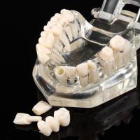 China Dental Student Education Model Standard for Dentistry Study Manual Power Source 2 Years Shelf Life for sale