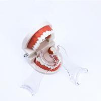 China Clear/Clear Blue Double Head Lip Retractor Dental Lip Cheek Opener Stainless Steel Surgical Tool with CCC Certification for sale