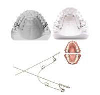 China Experience Effective Crossbite Palatal Expansion with CCC Certified Quad Helix Orthodontic Appliance for sale