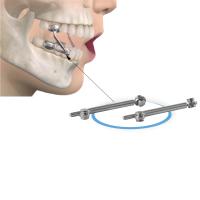 China Herbst Appliance Jaw Corrector 18-31mm Stainless Steel Orthodontic for sale