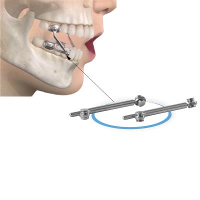 China Herbst Appliance Jaw Corrector 18-31mm Stainless Steel Orthodontic for sale