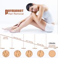 China CJ laser Hair Removal machine Ice Titanium diode laser 755 808 1064nm for sale