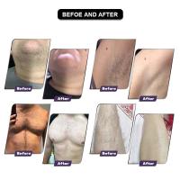 China Permanent 3 waves trio 808 755 1064nm ice titanium laser 808nm diode laser hair removal for sale