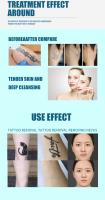 China ND YAG Laser Tattoo Removal Equipment Painless Treatment 1064nm 532nm for sale