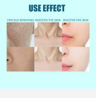 China Skin Tightening YAG Laser Machine White Black 1064nm 532nm 1320nm for sale