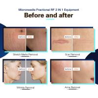 China CE FDA Fractional Rf Microneedling Machine Thermage Skin Rejuvenation Wrinkle Removal Face Lift for sale