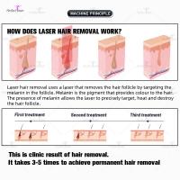China 3500W 808nm Diode Laser Hair Removal Machine Skin Rejuvenation for sale