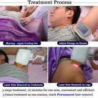 China 3500W Diode 808 Laser Hair Removal Machine 2 Handles All Types Hair Remover for sale