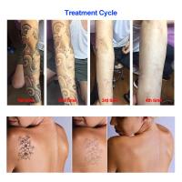 China Tattoo Pigment Removal Black Doll Laser Treatment Machine Perfectlaser Picosecond for sale