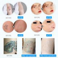 China 4 Wave Picosecond Laser Pigmentation Removal Machine For All Colors Tattoo for sale