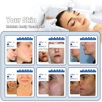 China 13 In 1 Hydrafacial Beauty Machine Diamond Microdermabrasion Aqua Peel Shrink Pores for sale