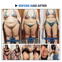 China Cryolipolysis Lipolaser Slimming Machine 6D Cellulite Removal Fat Reduction for sale