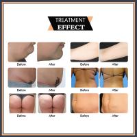 China Laser Lipolysis Lipolaser Slimming Machine 6D 532nm 635nm 600W for sale