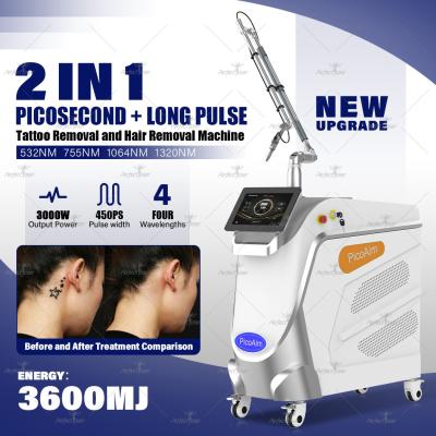 China 755NM Wavelengths Tattoo Removal Laser System for Safe and Effective Removal for sale