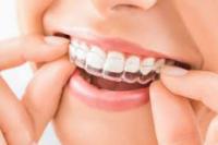 China Clear PETG Sheet Beautiful Teeth Aligners PETG Sheet Manufacturers for sale