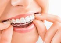 China Clear PETG Sheet Beautiful Teeth Aligners PETG Sheet Manufacturers for sale