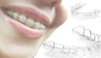 China Clear PETG Sheet Teeth Aligners PETG plastic sheet cutting PETG 125mmX0.6 0.75 1mm for sale