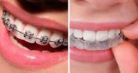 China 125MM Plastic Aligners PETG Sheets 0.6MM 0.75MM 1MM for sale