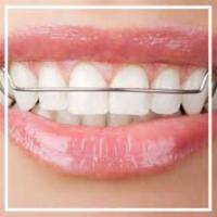 China 0.5mm 0.8mm 1.0mm 1.5mm 2mm 3mm 4mm 5mm 6mm 7mm  Transparent PETG Plastic Sheets for Orthodontic appliance for sale