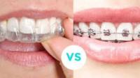 China PETG Thermoform Plastic Sheet 0.5mm PETG Clear Plastic Sheet For Invisalign Teeth Aligners for sale