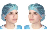 China Metal Strip Design Surgical Head Cover Flexible Lightweight Without Glass Fibers for sale