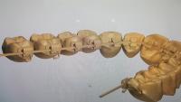 China Powerful Machinery Source DTC Orthodontics Lingual Braces with Self-Ligating Brackets for sale