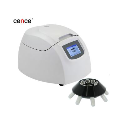 China TD4 PRP PRF Centrifuge with 4000rpm Speed 1980xg RCF and 8 x 15ml Capacity for Blood Separation for sale