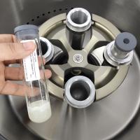 China PRP Centrifuge with 5000rpm Max Speed, 3555xg Max RCF, and LCD Display for Clinical Medicine for sale