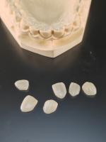 China Strength E.MAX Veneer Natural Translucency Gradient 0.3mm Crown Cut Veneer for sale