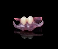 China Thermoplastic Resin Denture Base Hypoallergenic Flexible Dental Partials for sale