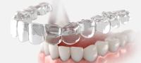 China Invisible Orthodontic Dental Clear Aligner Discreet Comfortable Dental Aligner for sale