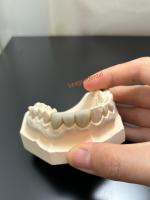China Precision Crafted Porcelain PFM Crown Biocompatible Porcelain Fused To Metal for sale