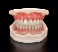 China Pink White Metal Framework Denture Natural Fit Full Denture Precision for sale