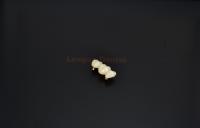 China Glazed Cement Retained Implant Crown High Strength Implant Cemented Crown for sale