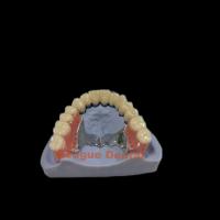 China Implant Multi Unit Abutment Cement Retained Sleeve Crown Safe Hypoallergenic for sale