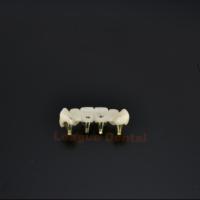 China Strength And Precision Titanium Custom Abutment Implant Restorations for sale