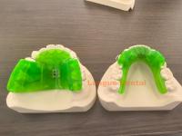 China Adjustable 3 Way Palatal Expander High Strength Removable Palate Expander for sale