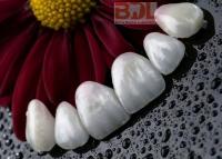 China Prosthesis Material IPS Emax Veneer 16 Shade Scale Dentin Enamel Metal Free Composition for sale