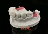 China Adaptable Bone Density TypeⅡ-Ⅳ Bone Dental Implant Bar Component For Dental Restoration for sale